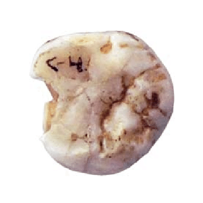 FamilyTreeDNA Discover - Y-DNA Haplogroup T-FTB83607